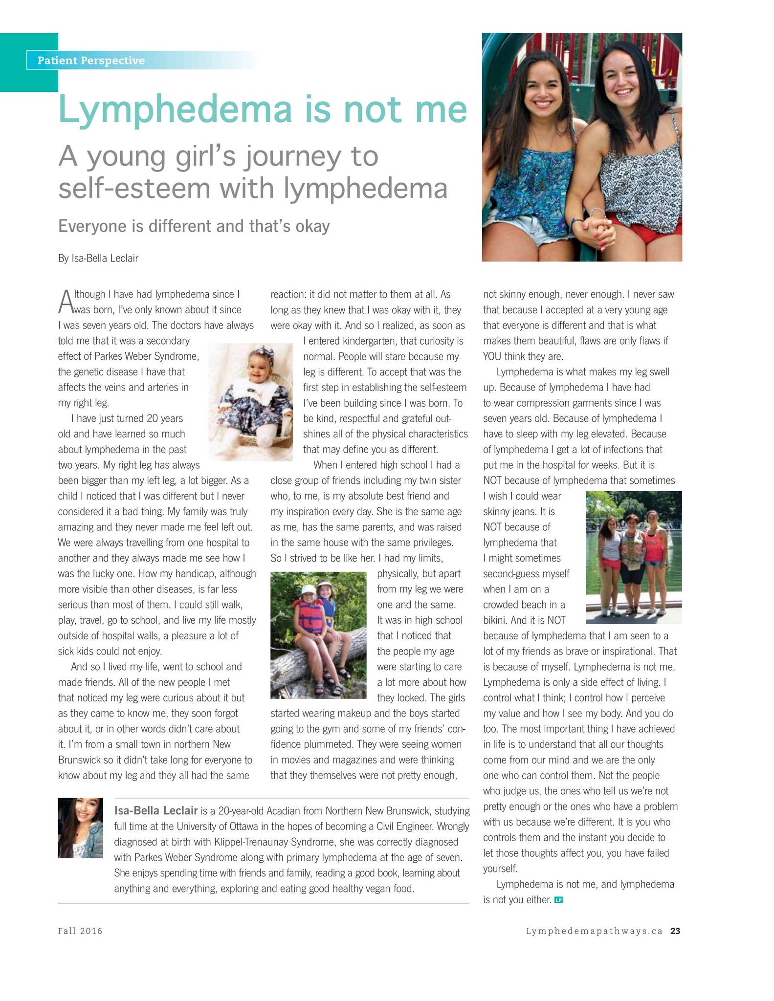 Lymphedema is not me. A young girl's journey to self-esteem with lymphedema. by Canadian ...