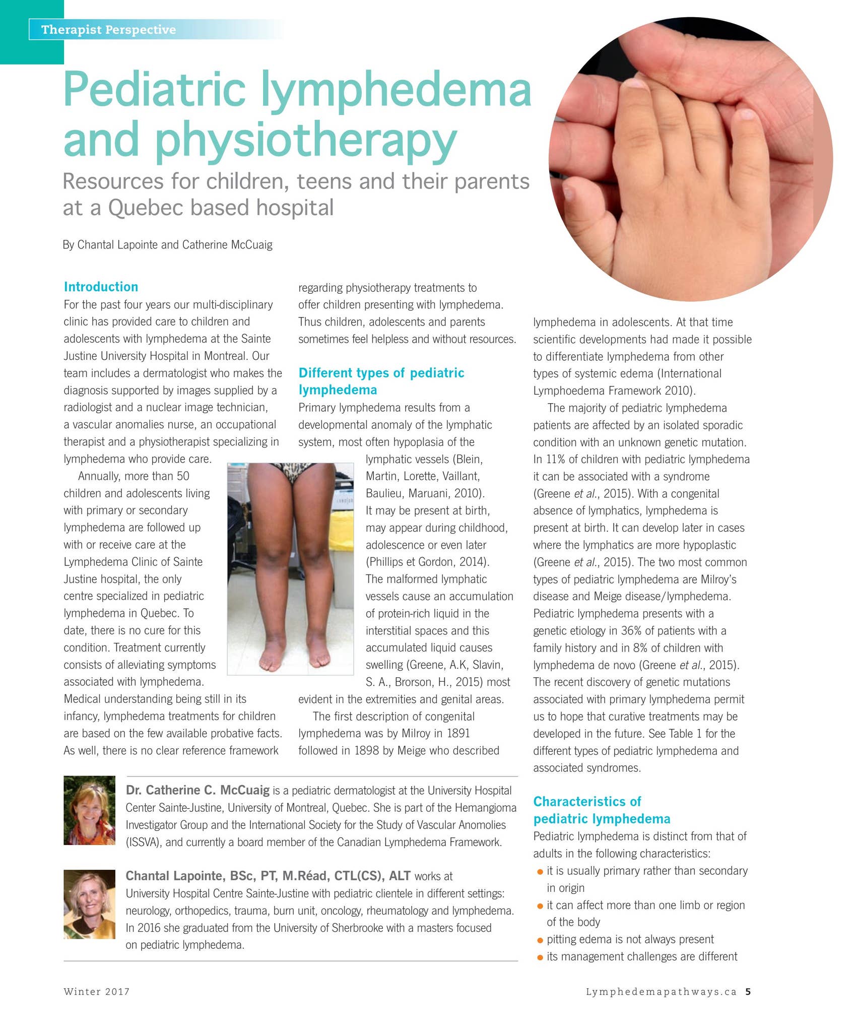 Pediatric lymphedema and physiotherapy. Lapointe, C., McCuaig, C. Winter 2017. by Canadian ...