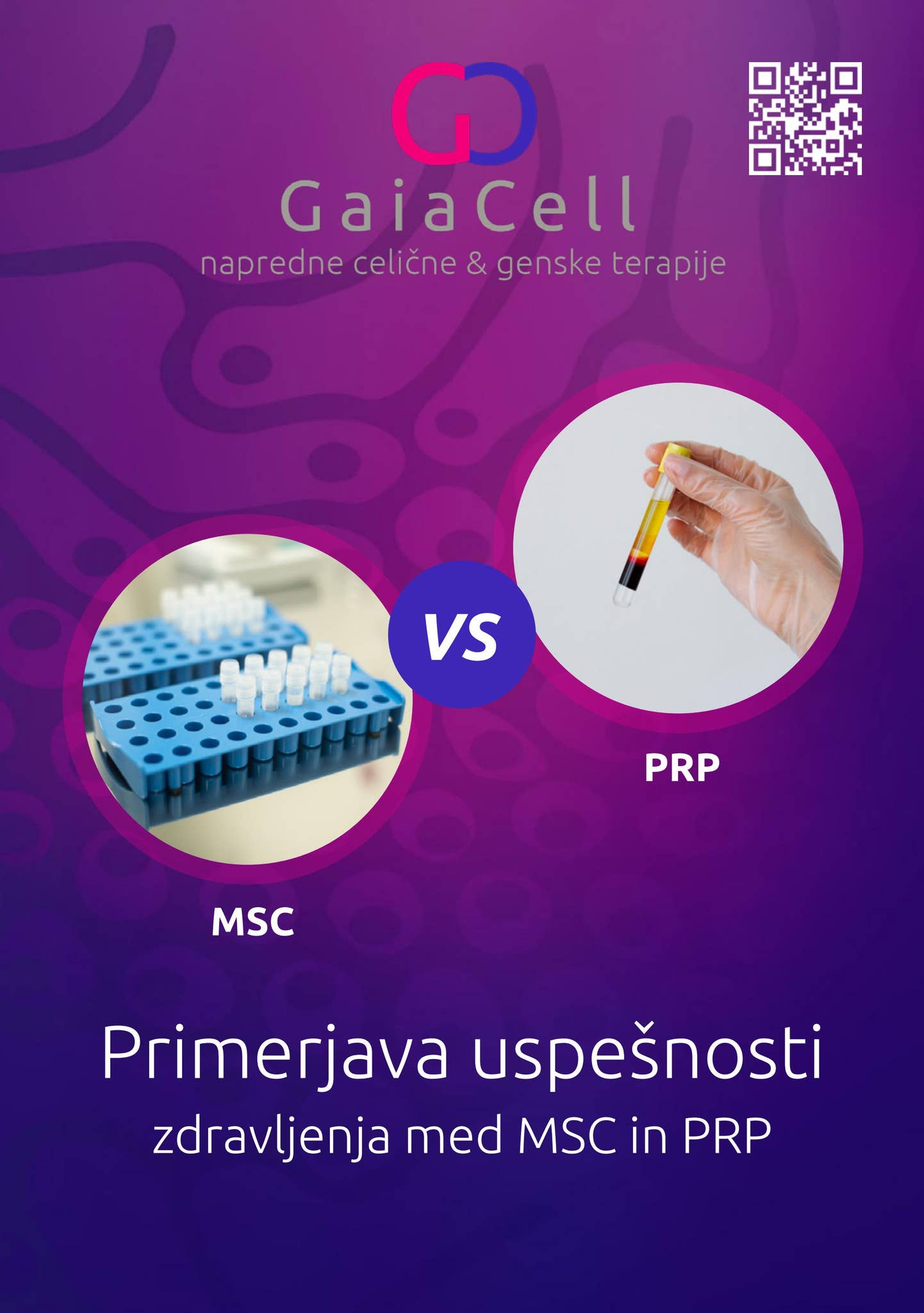 Primerjava uspešnosti zdravljenja s terapijami MSC v primerjavi s PRP ...