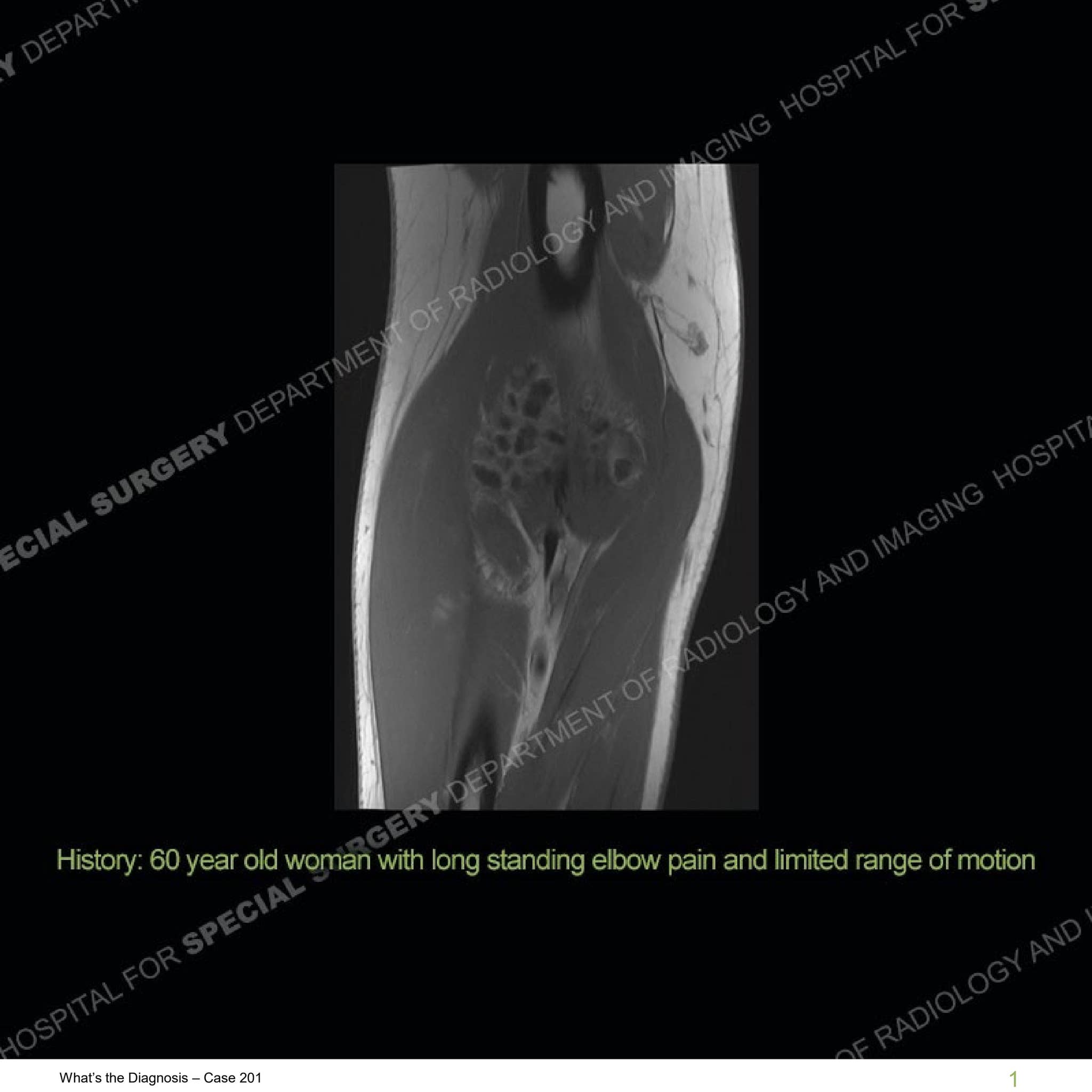 HSS What's the Diagnosis Case 201 by Hospital for Special Surgery - Issuu
