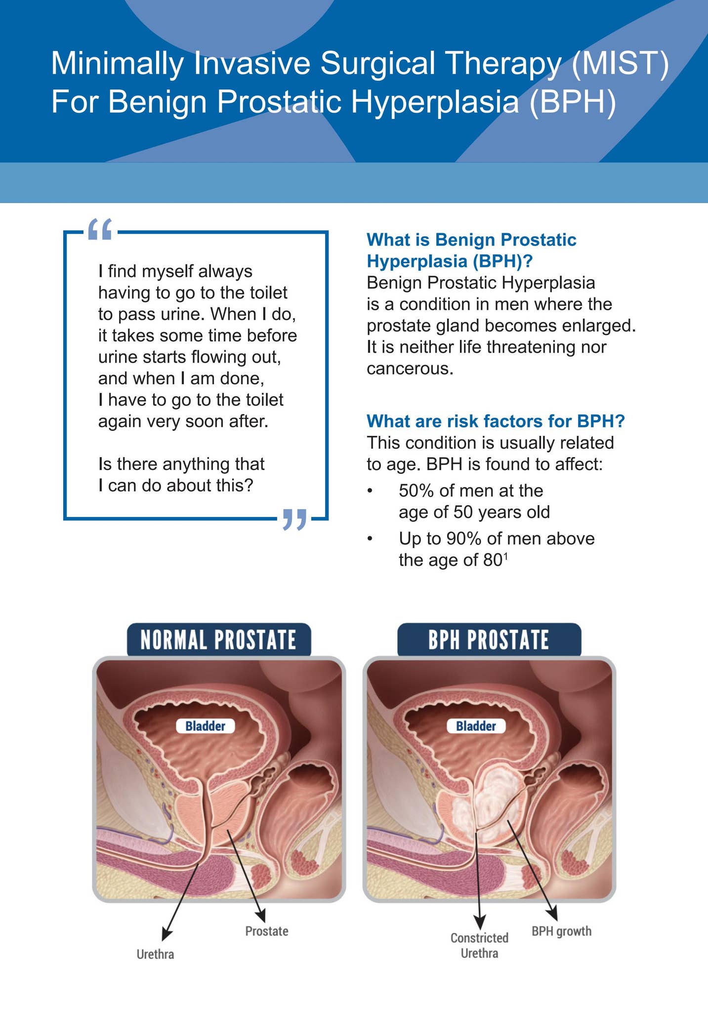 Minimally Invasive Surgical Therapy (MIST) For Benign Prostatic ...
