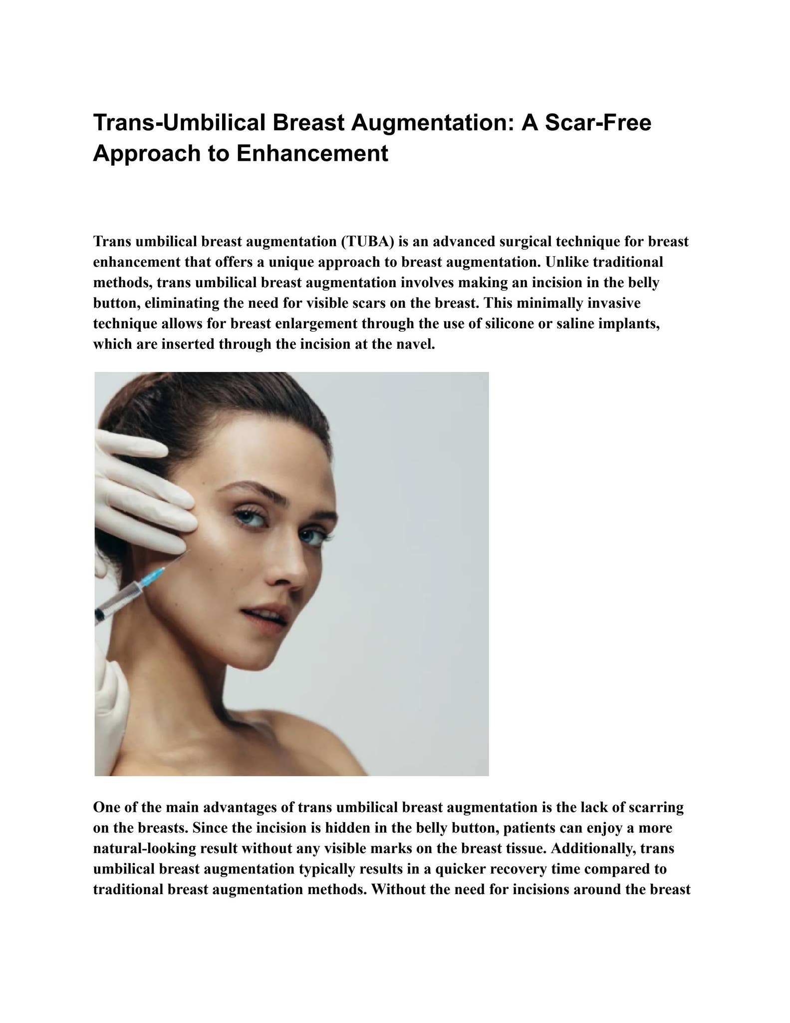 Trans-Umbilical Breast Augmentation_ A Scar-Free Approach to ...