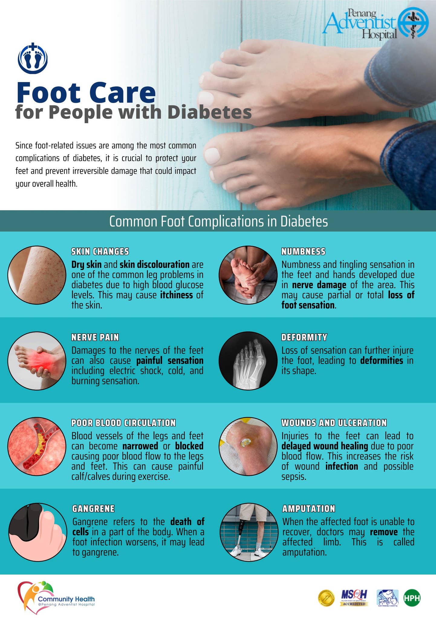 Diabetic Foot Care Posters