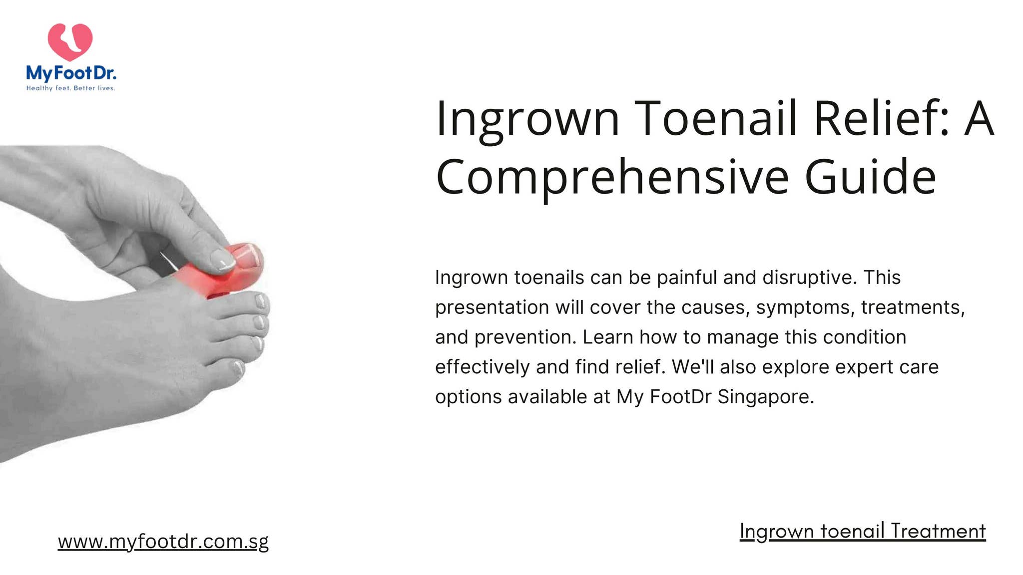 Ingrown Toenail Relief : A Comprehensive Guide by My FootDr - Issuu