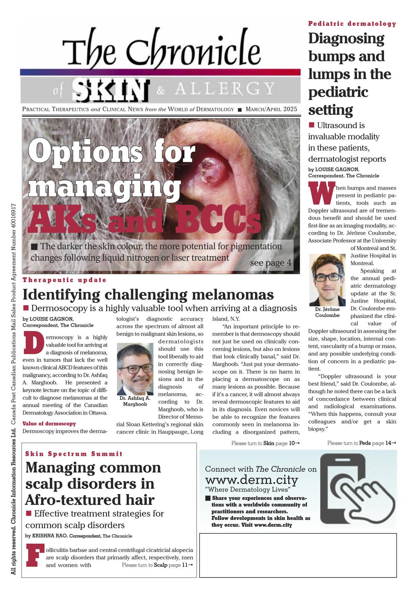 The Chronicle of Skin & Allergy - Mar/Apr 2025 by Derm City - Issuu