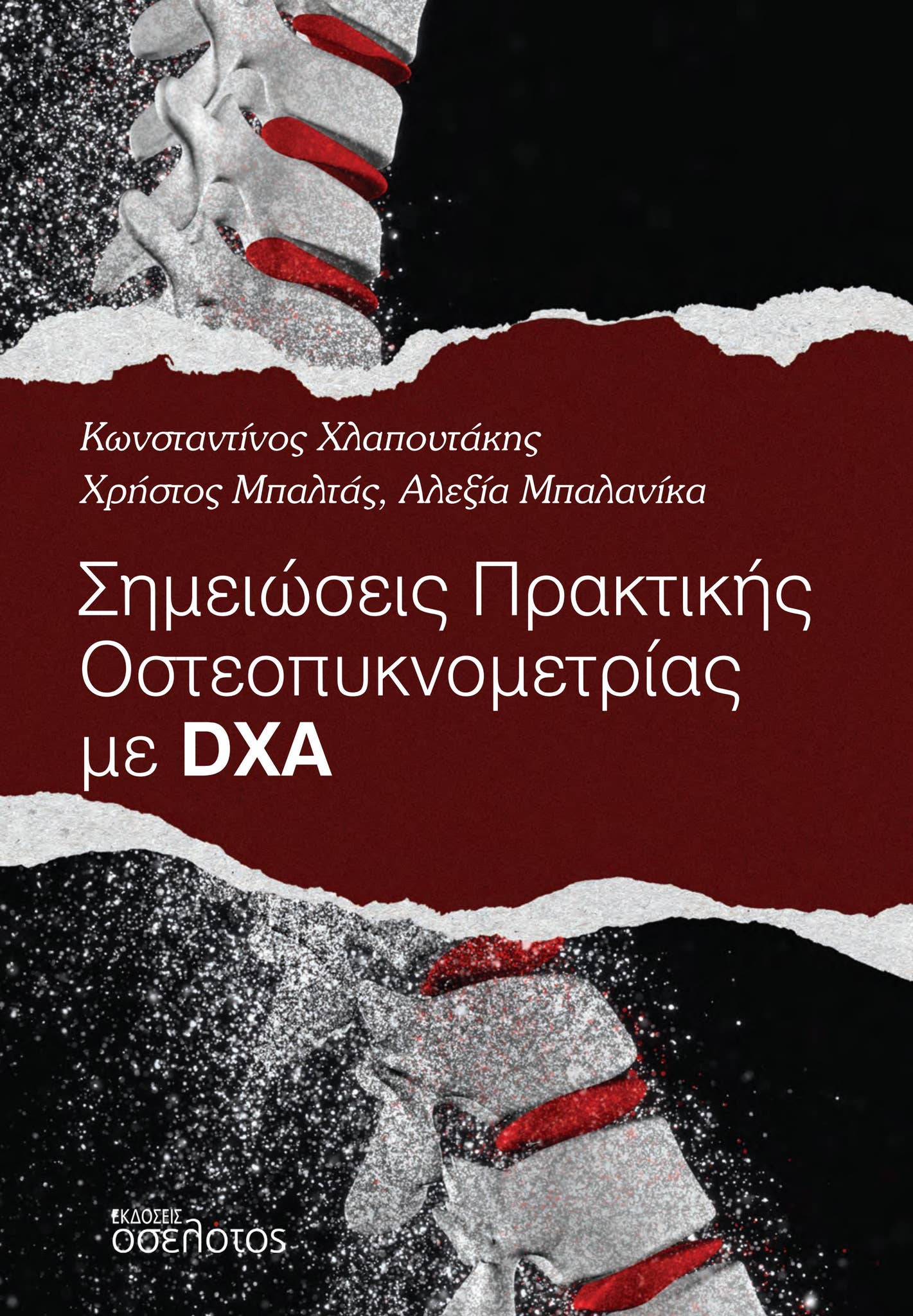 Σημειώσεις Πρακτικής Οστεοπυκνομετρίας με DXA by Εκδόσεις Οσελότος - Issuu