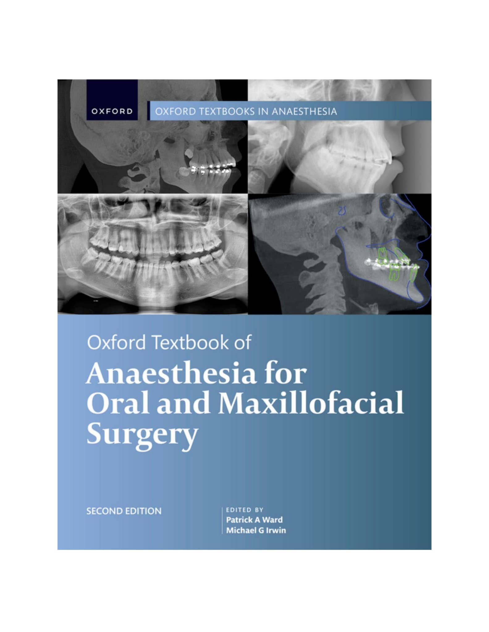 pdf(eBook) Oxford Textbook of Anaesthesia for Oral and Maxillofacial ...