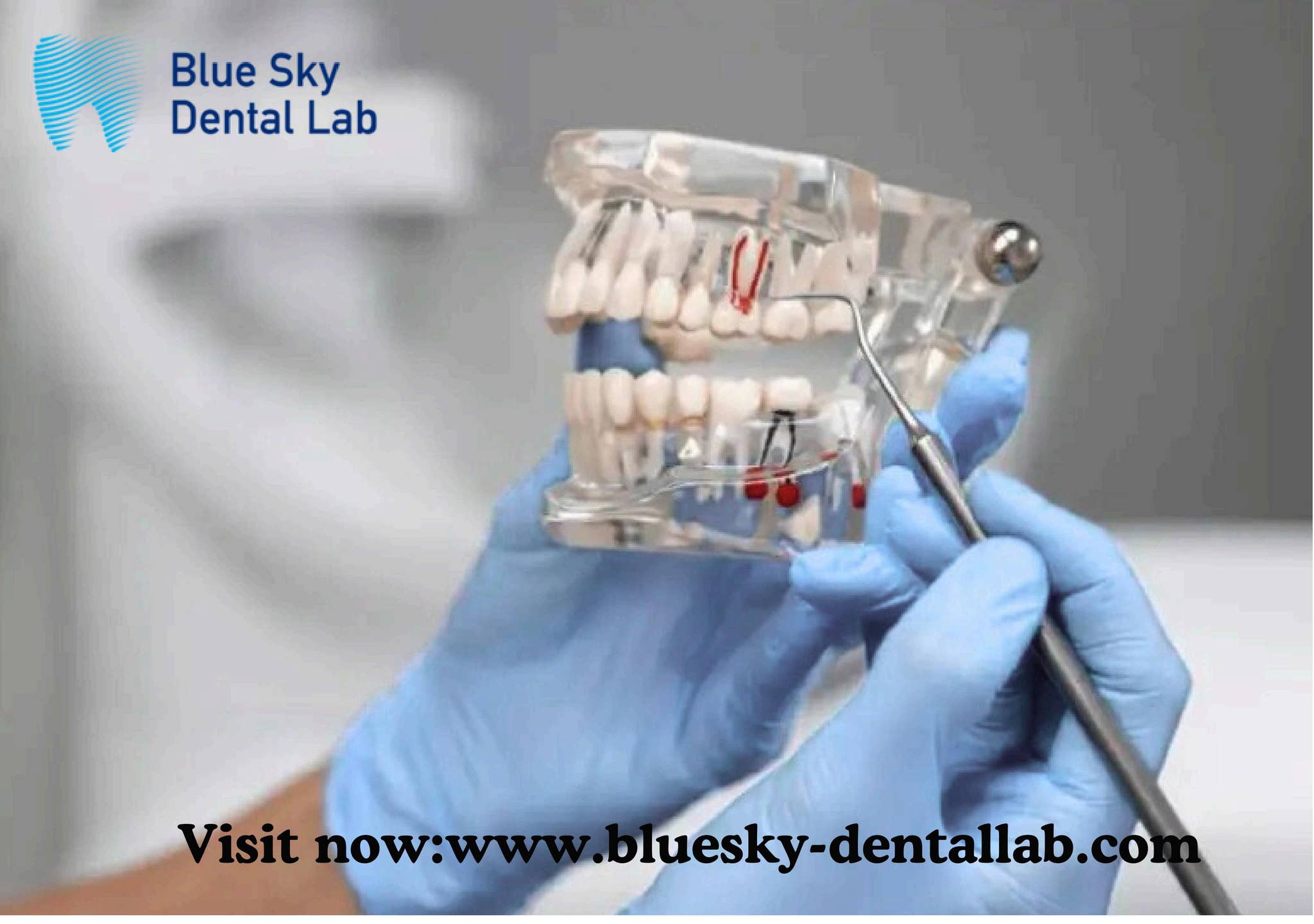 Malo Bridge Dental Implant Solutions for Lasting Smiles | Blue Sky ...