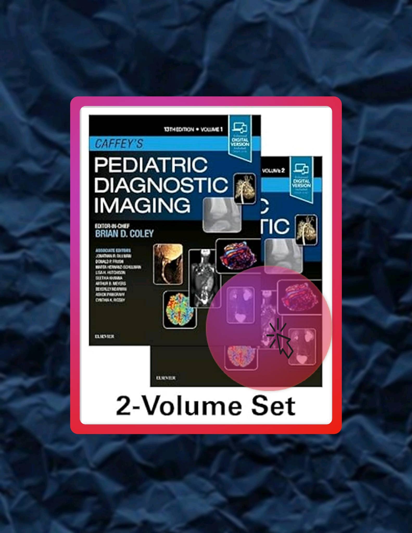 Ebook Version Caffey's Pediatric Diagnostic Imaging, 2-Volume Set by ...