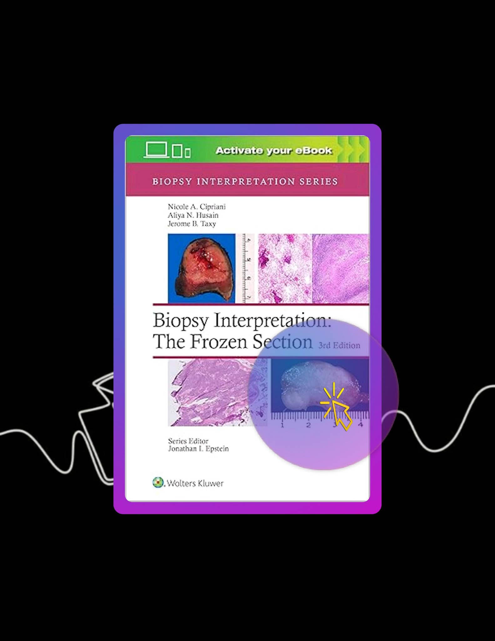 Fast Access Biopsy Interpretation: The Frozen Section: Print + eBook ...