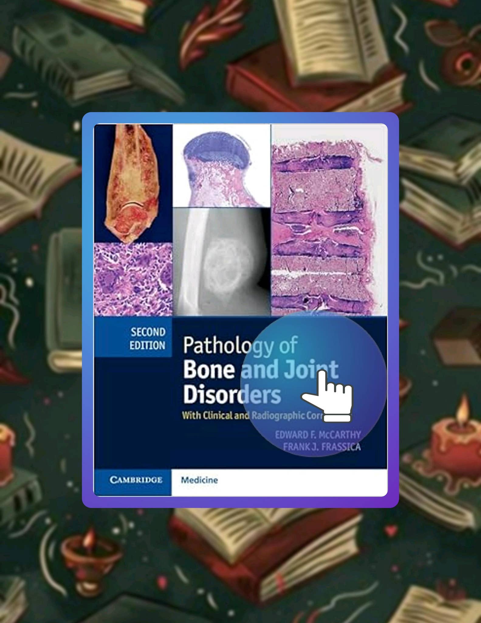 Digital Book Pathology of Bone and Joint Disorders Print and Online ...