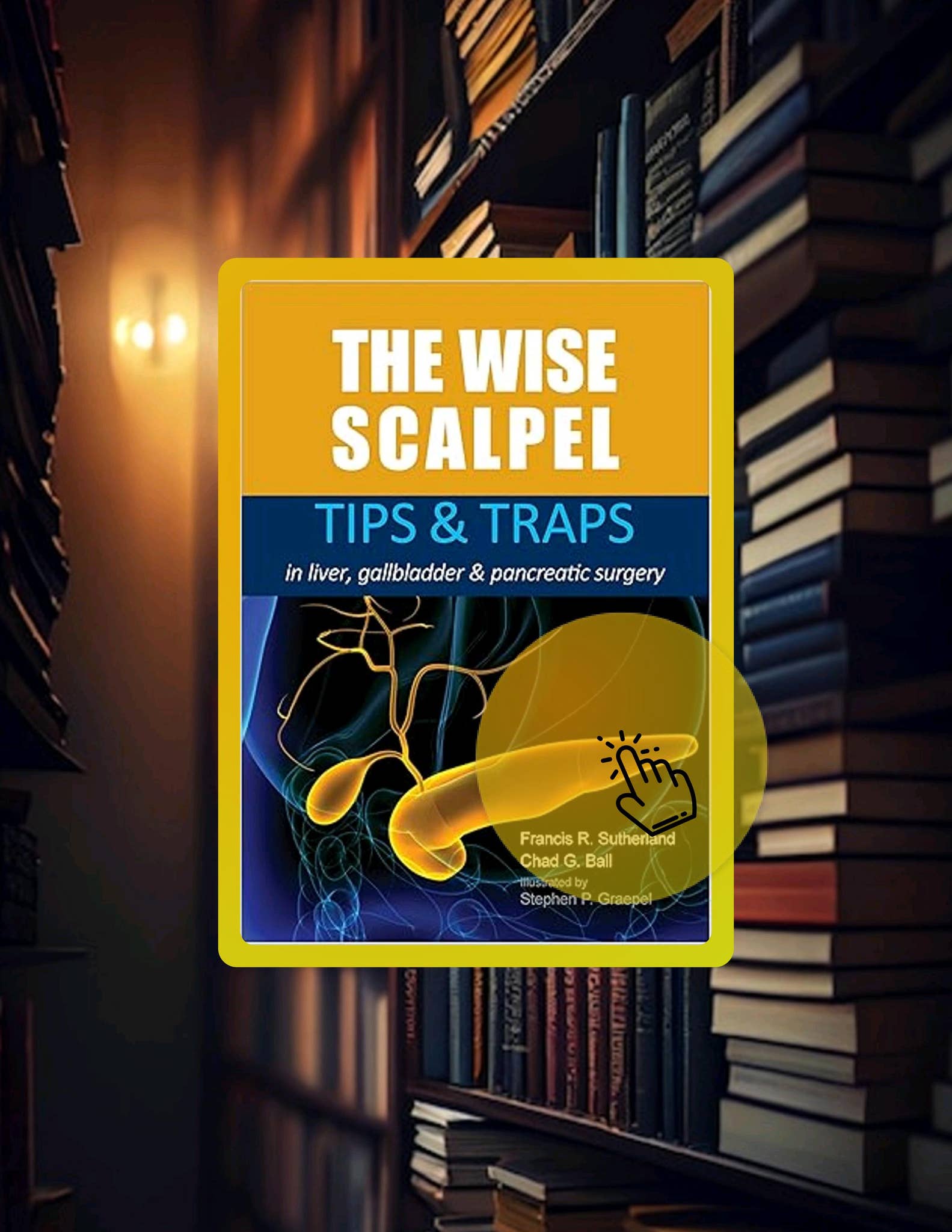 Start Reading The Wise Scalpel: Tips & Traps in liver, gallbladder ...